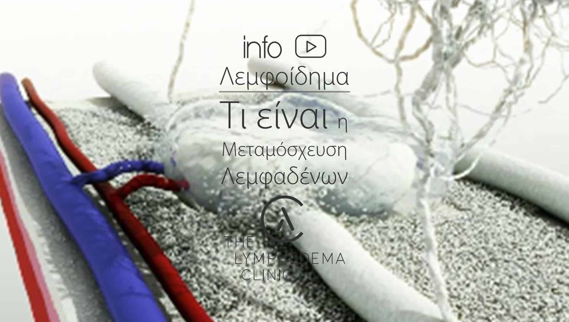 Λεμφοίδημα | Τι είναι η Μεταμόσχευση Λεμφαδένων - Κλινική για το ...